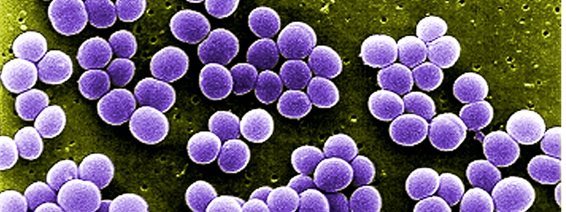 Scratching the surface: the skin microbiome and atopic dermatitis ...